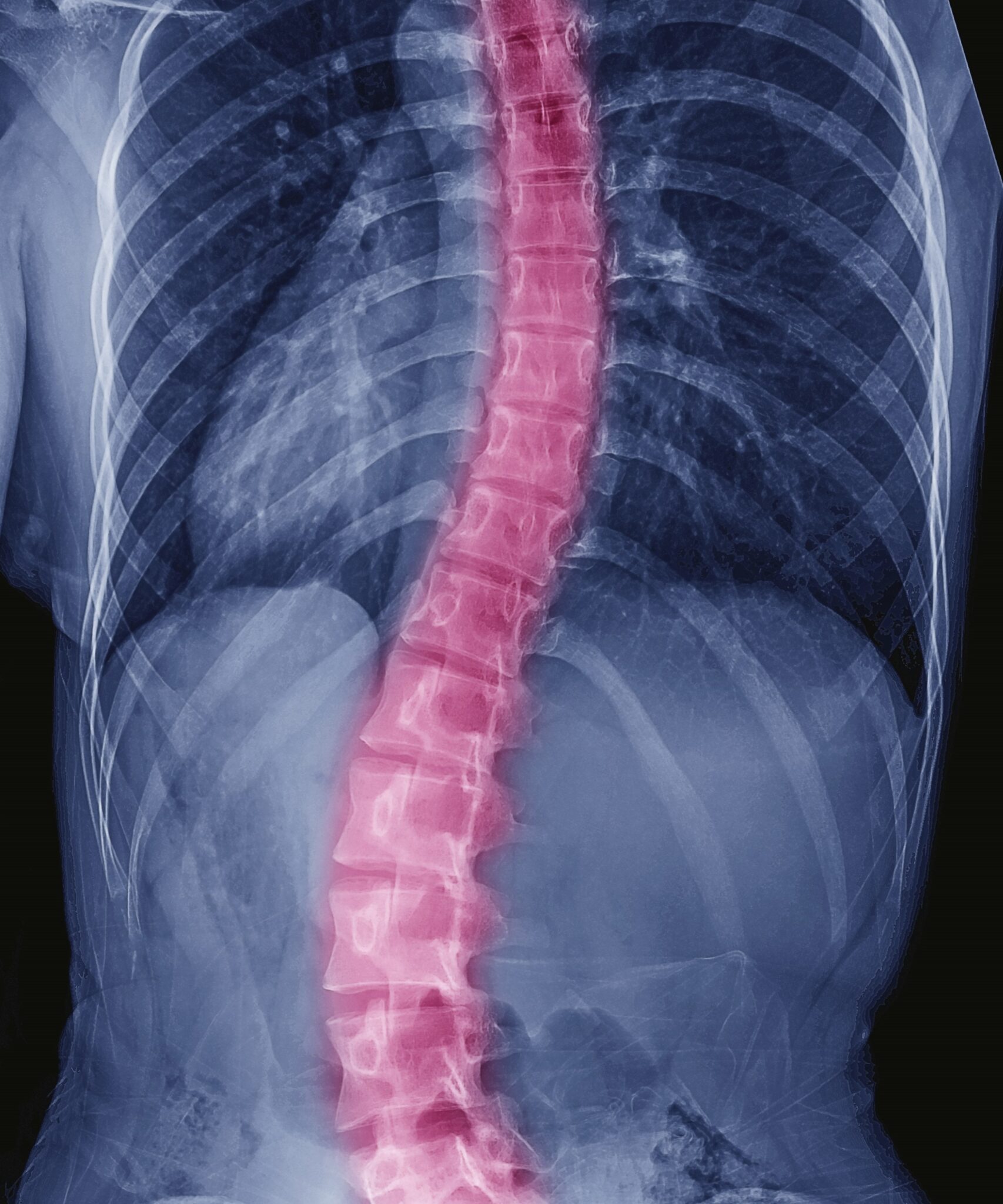 Products - Scolio-Pilates